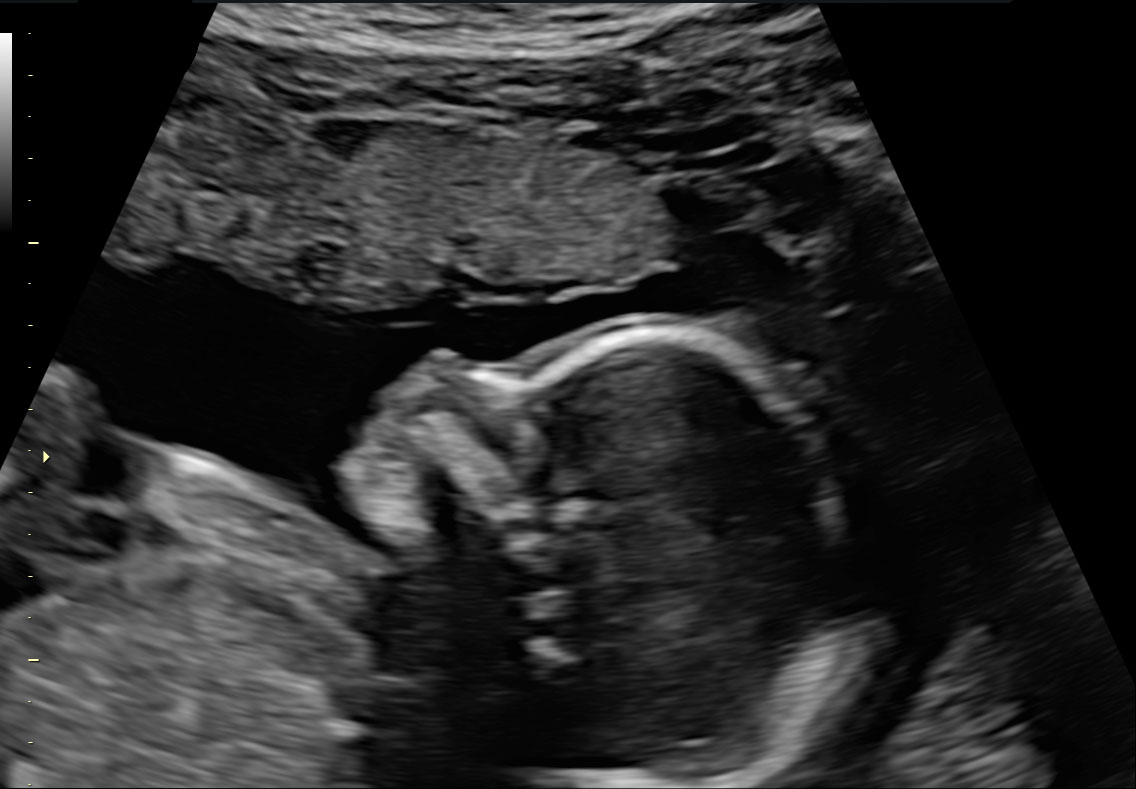 21 Weeks (Or, Oh I’m Definitely Pregnant. Very Pregnant.) | A Virginia ...